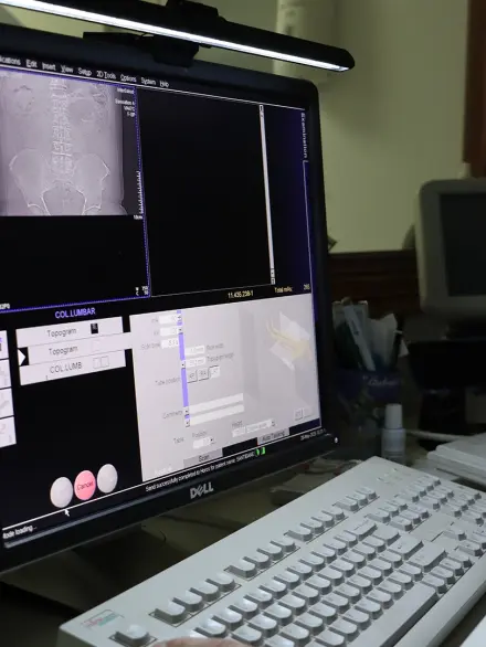 Somos - Interscanner